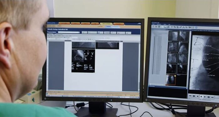 Xper Information Management | Datenmanagement und Physiomonitoring System